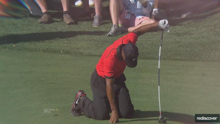 What we learned from Tiger Woods' revealing spinal surgery interview