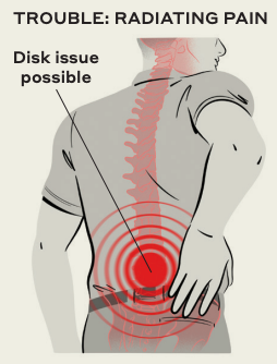 Golf injury: How to tell if your back is just sore or if it's something ...