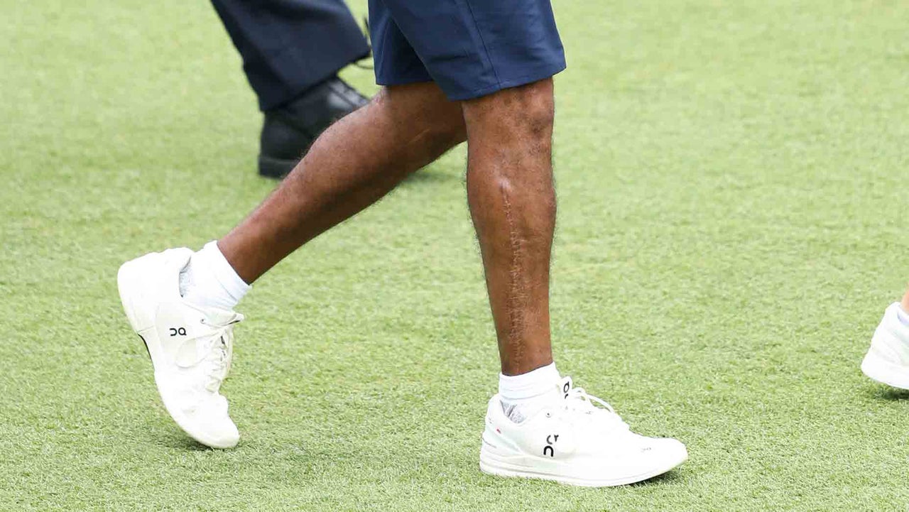 What does Tiger Woods’ injured right leg look like? New photos show scars