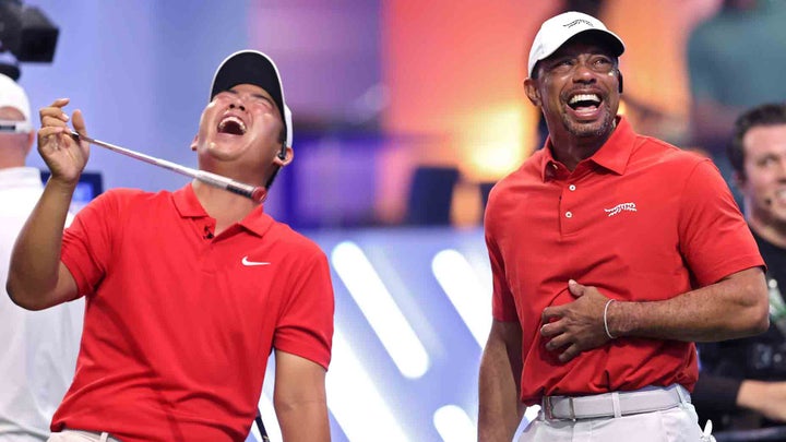 What does Tiger Woods’ injured right leg look like? New photos show scars